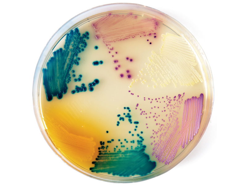 科瑪嘉 CHROMagar Orientation - | CHROMagar | Neogen | Acumedia | JNC ...